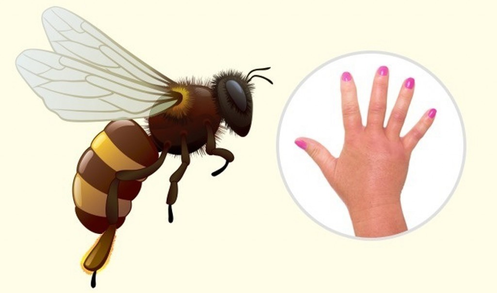 Како да ги препознаете најчестите убоди од инсекти?